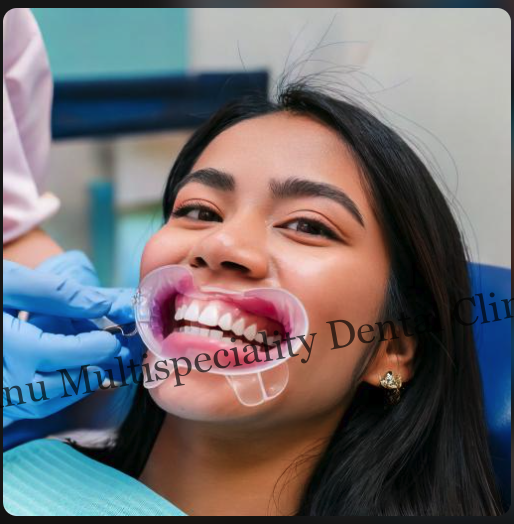 What Is Professional Teeth Cleaning? A Complete Guide - Banu Dental